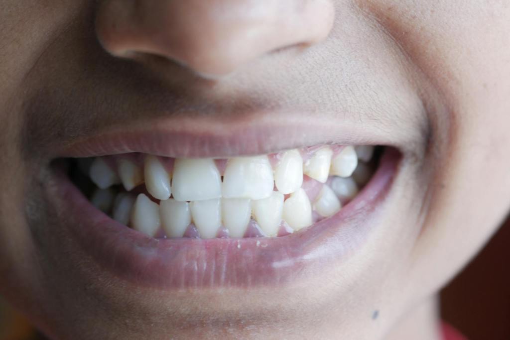 Fluoride isn’t for Teeth, it’s for YOUR obedience | MrKidPool17 | Sunny ...